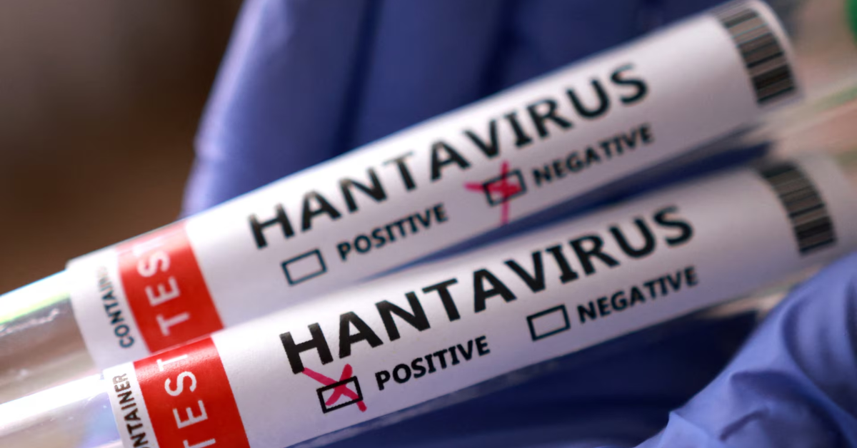 What is Hantavirus Outbreak 2026: Symptoms, Vaccine Status, and the ...